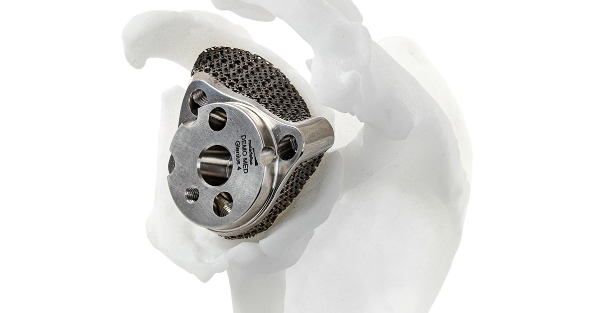 Webinar: Improve Clinical Outcomes with Personalized Shoulder Implants
