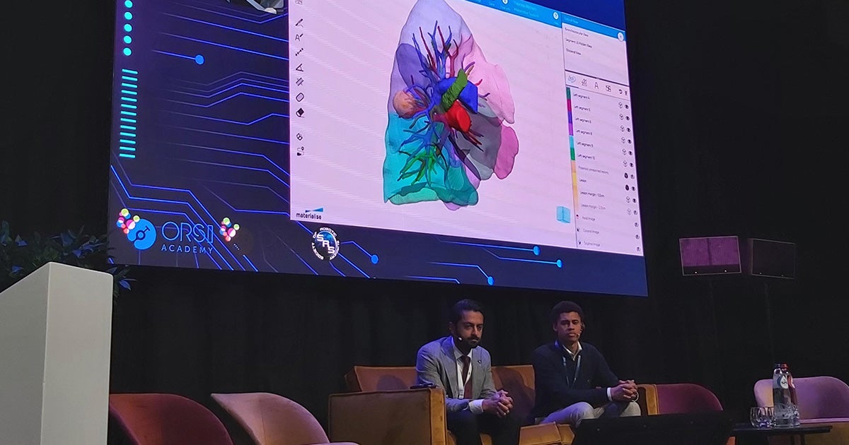 The Future of Thoracic Surgery: 3D Models on Intraoperative Video