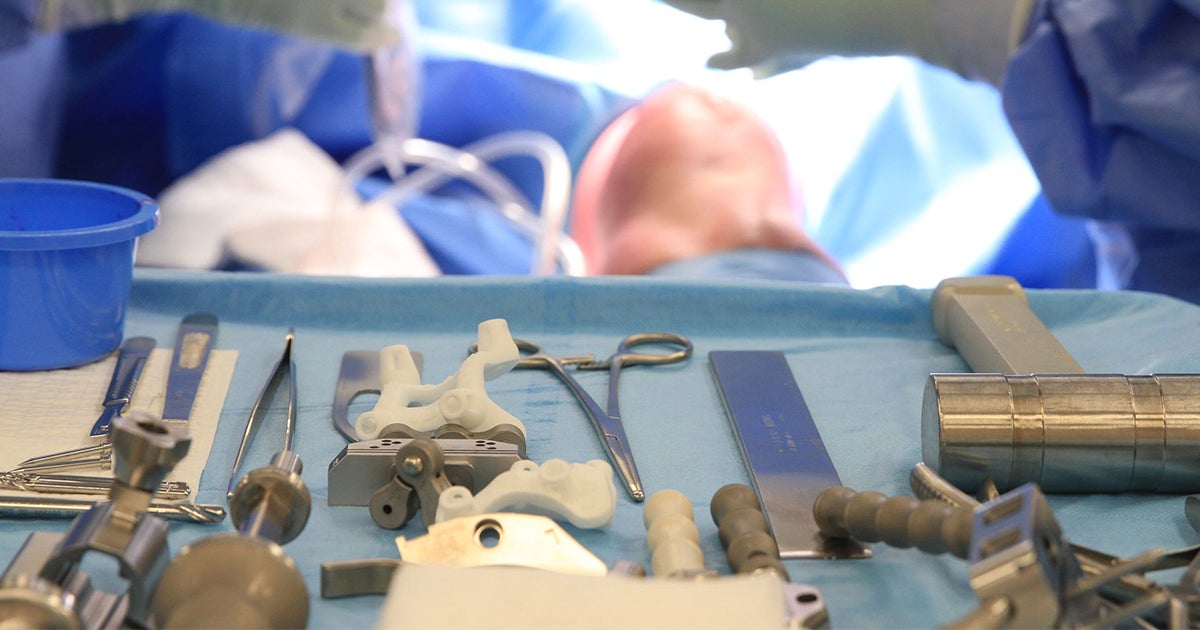 Why Enabling Technology Is Critical for Personalized Knee Alignment