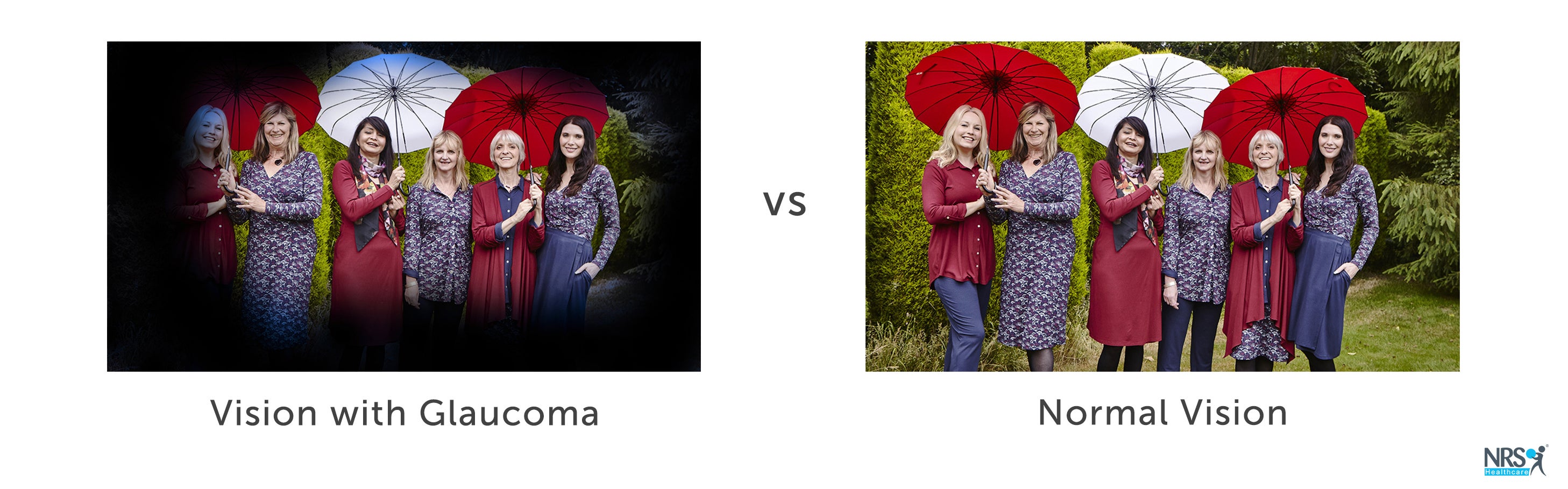 What does vision with glaucoma look like? | Healthcare Pro - NRS ...
